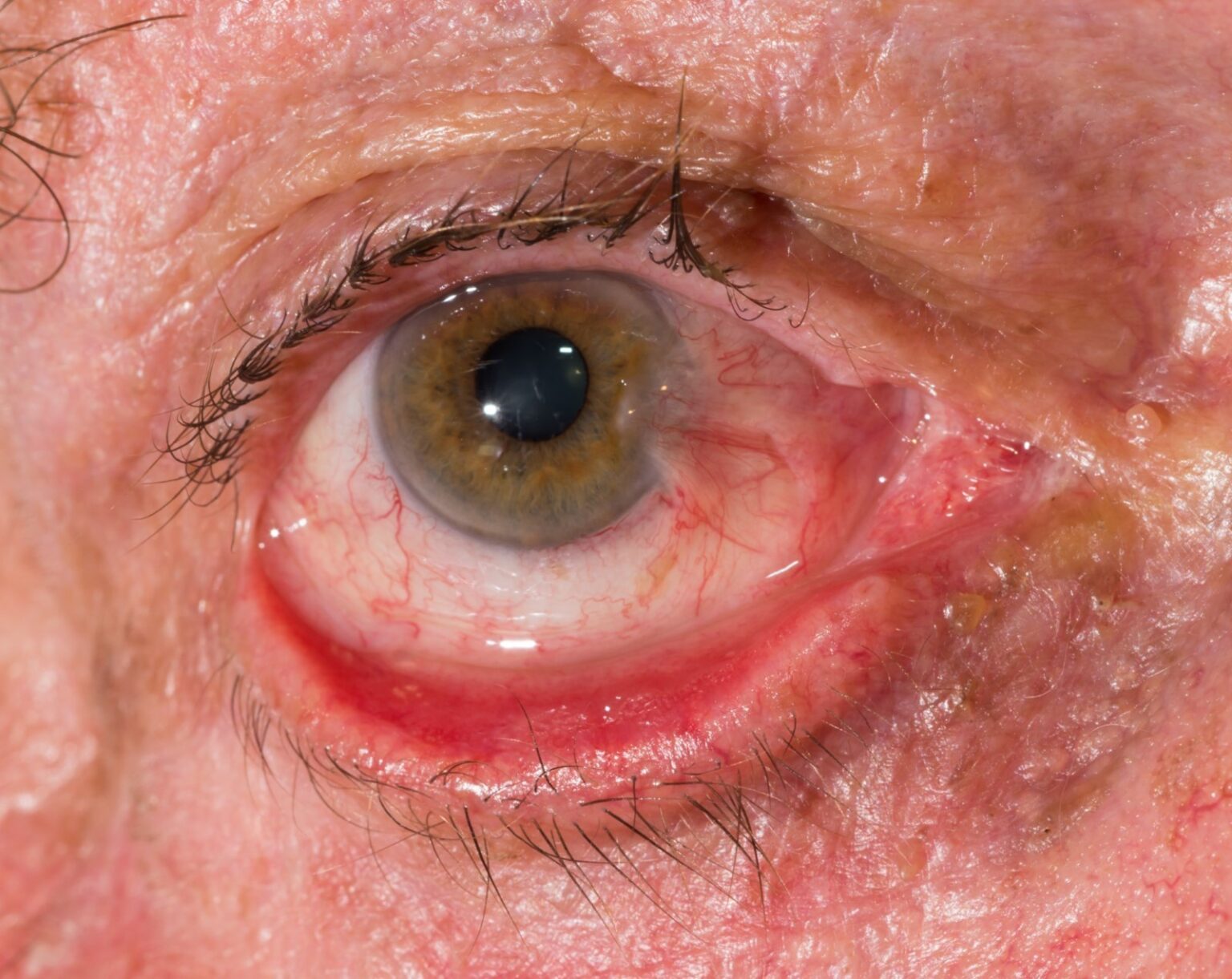 Why Entropion Occurs and How to Prevent It: A Comprehensive Guide ...